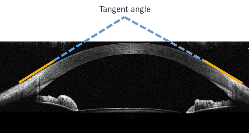 Menicon Z Night | Products | Professional | Menicon Australia